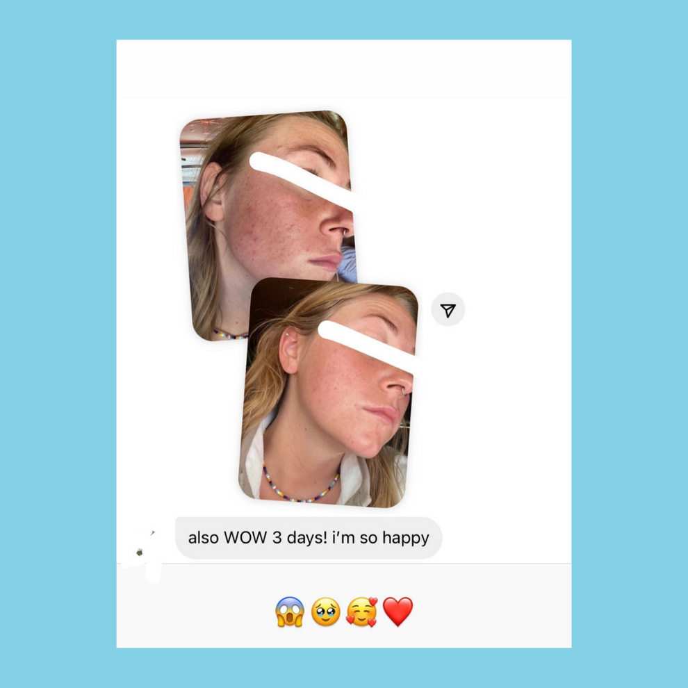 Starter Reset Program™ – PuraU