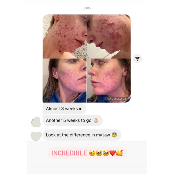 Advanced Reset Program™ – PuraU