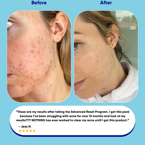 Advanced Reset Program™ – PuraU