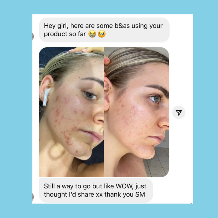 Advanced Reset Program™ – PuraU