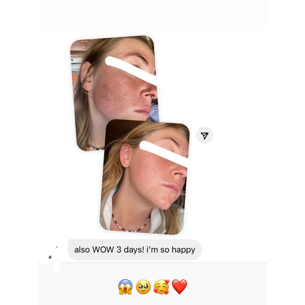 Advanced Reset Program™ – PuraU