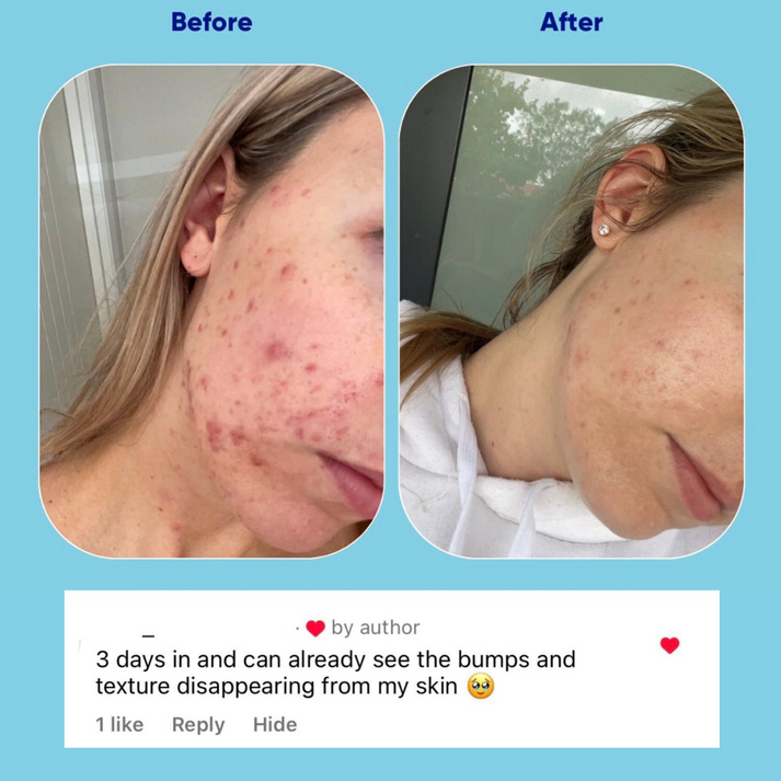 Intermediate Reset Program™ – PuraU