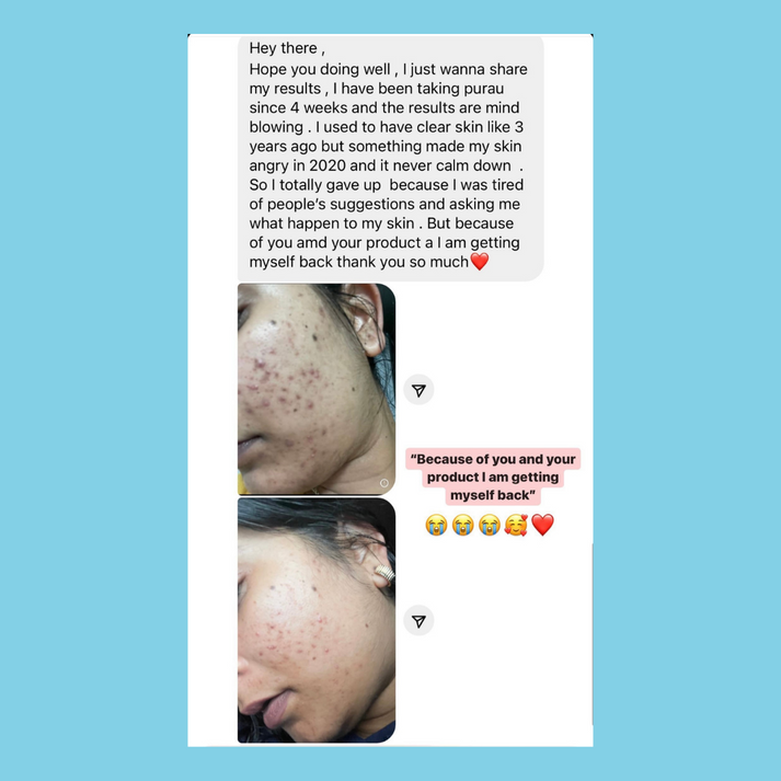 Starter Reset Program™ – PuraU