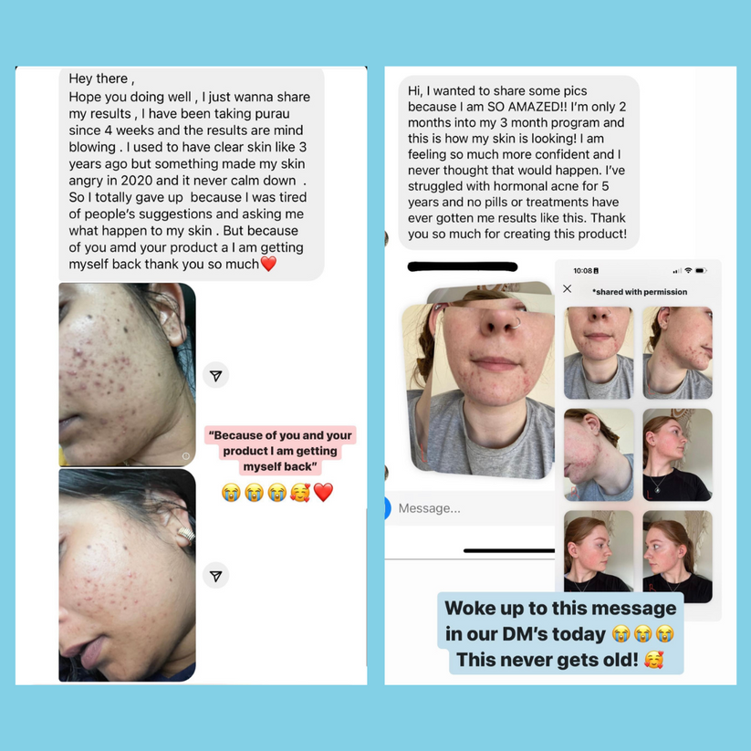 Intermediate Reset Program™ – PuraU