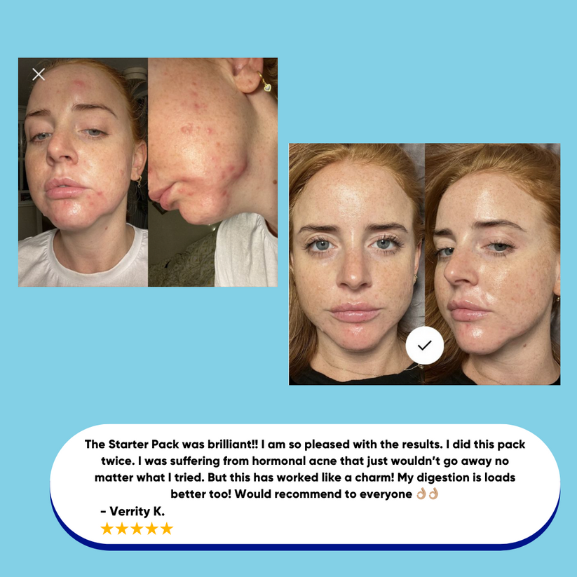 Starter Reset Program™ – PuraU