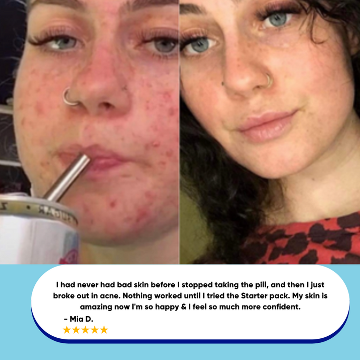 Starter Reset Program™ – PuraU