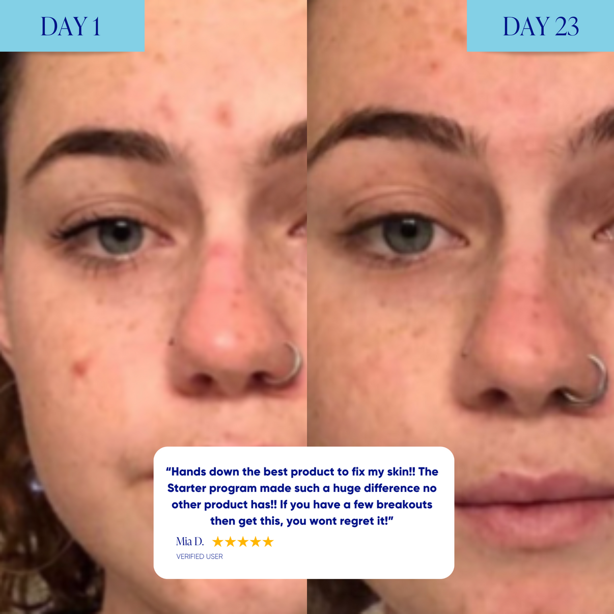 Starter Program™ – PuraU